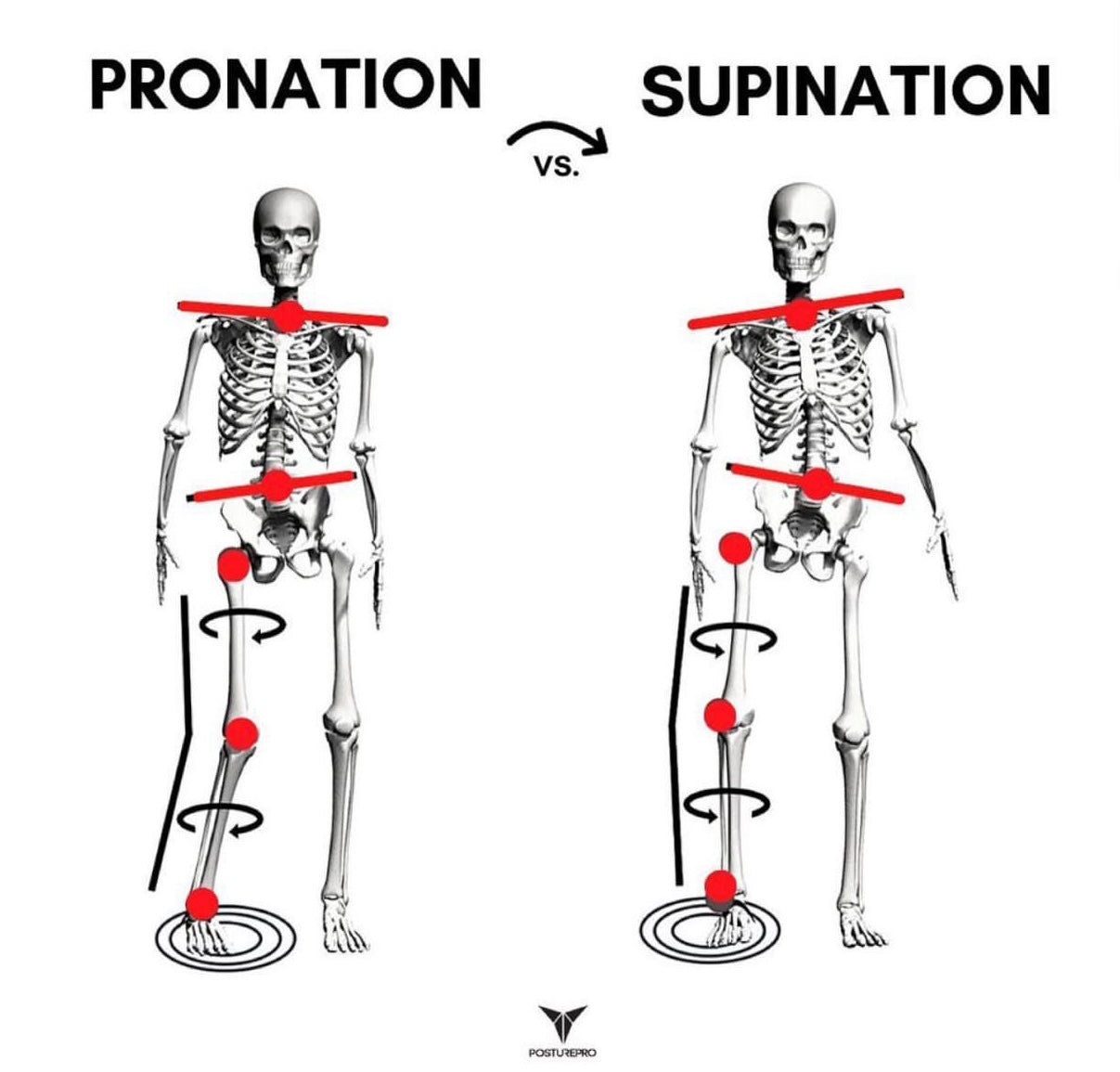 Fix Uneven Foot Posture & Flat Feet – Posturepro EU